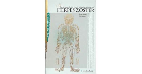 Acupuncture and Moxibustion for Herpes Zoster | Herbs & Touch